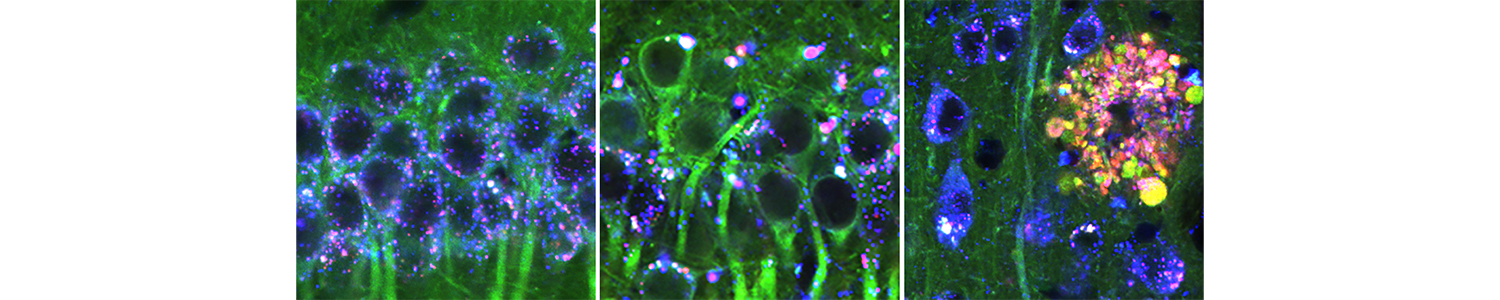 DunSheng Yang, PhD laboratory | Center for Dementia Research